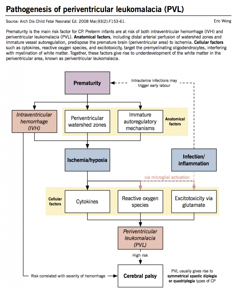 Cerebral palsy – McMaster Pathophysiology Review